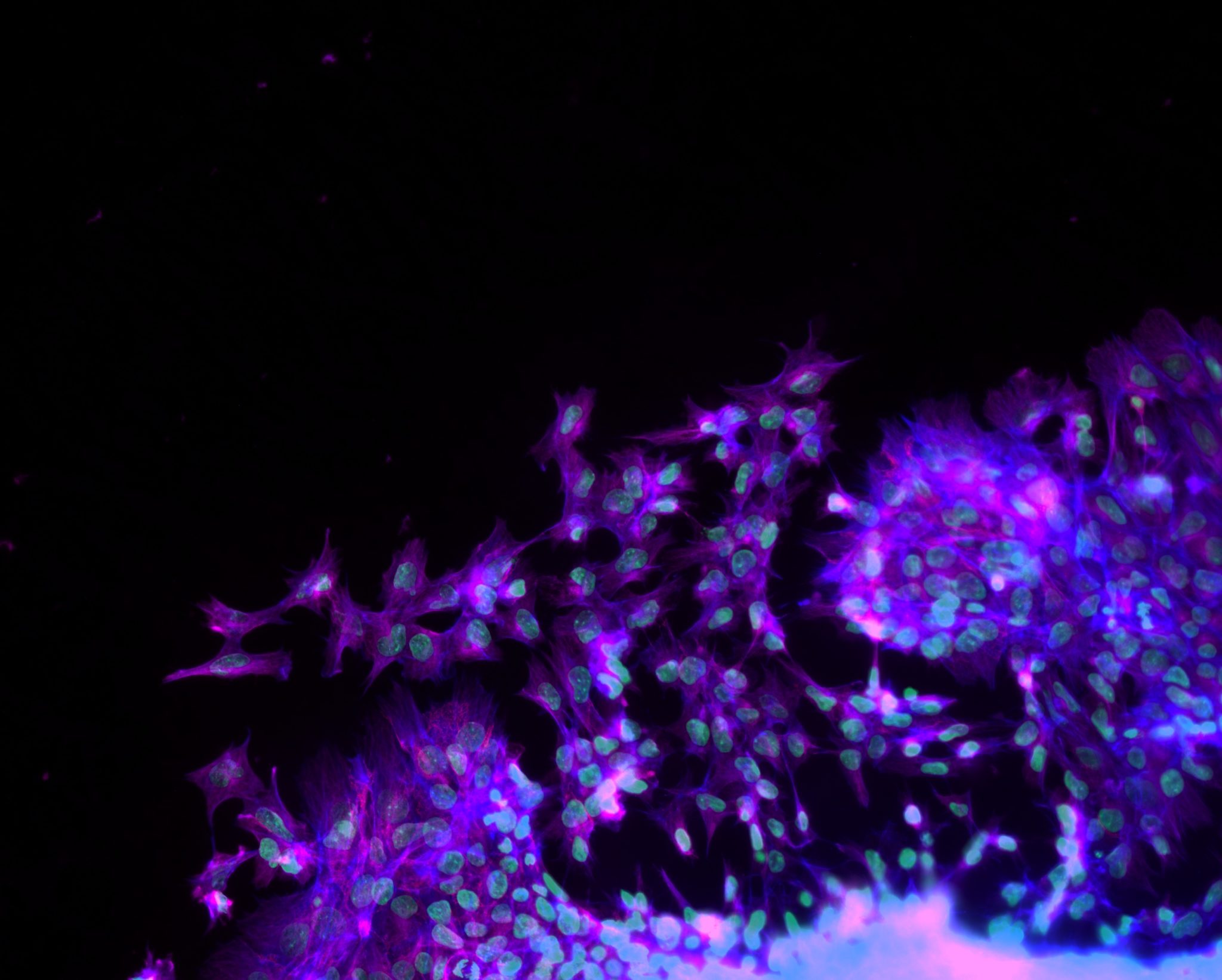 LSS 110: Studying Migration of Metastatic Cancer Cells and Embryonic ...